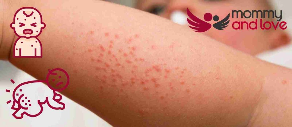 Can Heat Cause Diaper Rash? - Mommy and Love