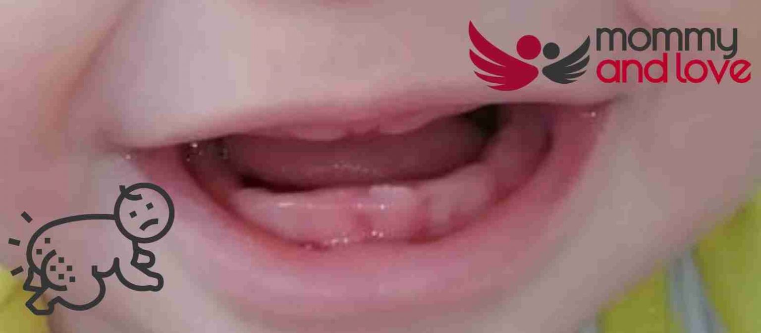 Can Teething Cause Bad Diaper Rash? - Mommy and Love