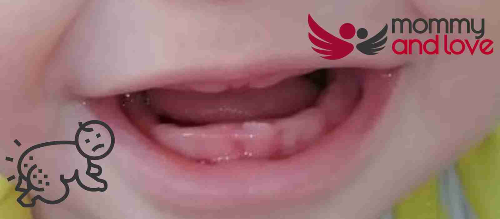 Can Teething Cause Bad Diaper Rash Mommy And Love